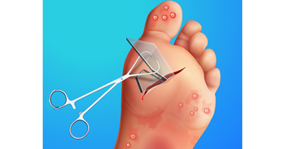Foot Doctor - Play Foot Doctor Game on BabyGames